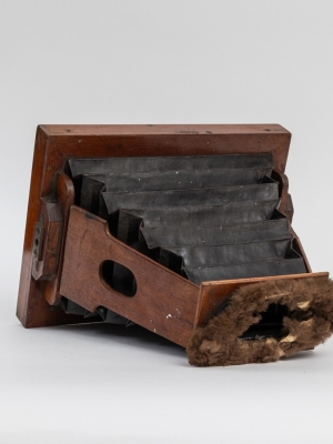 Bonnette ou lorgnette radiologique | SFR