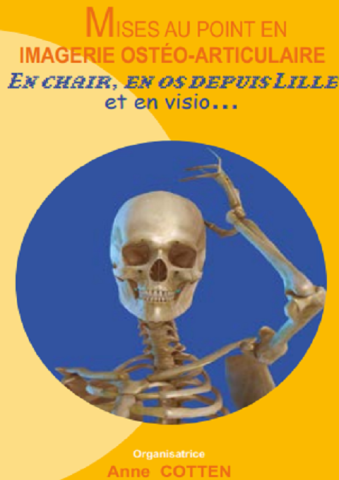 lille g.png | SFR