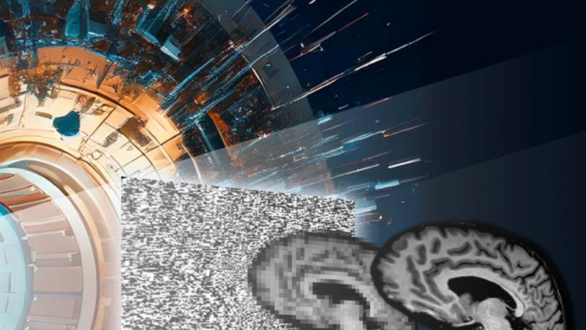 DU DIU AUEC manipulateur IRM | SFR