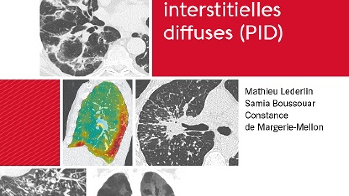 Syllabus « Imagerie des Pneumopathies Interstitielles Diffuses ...