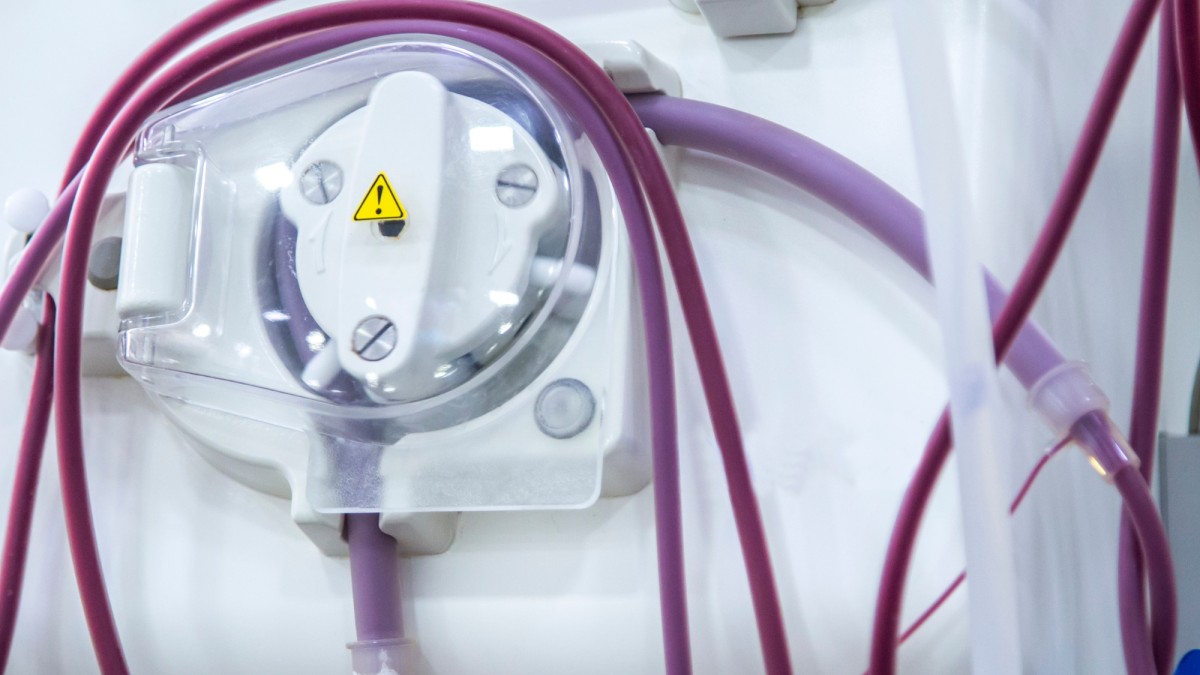 Sténose sur FAV d’hémodialyse : devrions-nous être plus actifs ? | SFR