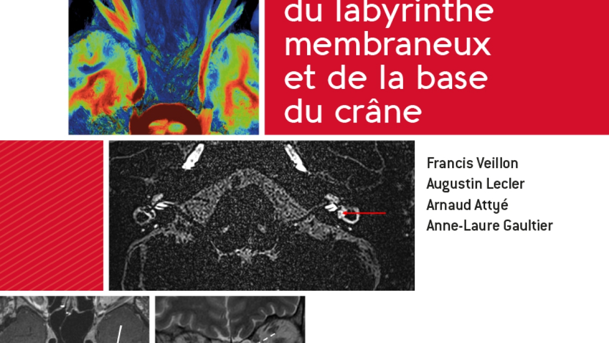 2022 - Imagerie de l'orbite, du labyrinthe membraneux et de la base du crâne | SFR